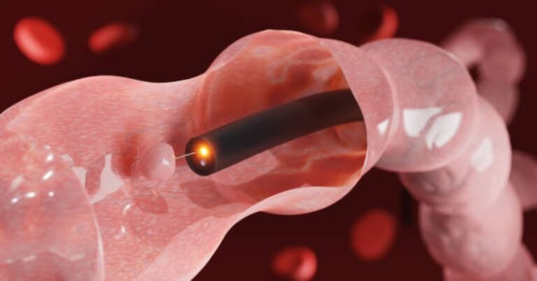 FDA approves Fujifilm AI endoscopy technology that could compete with ...